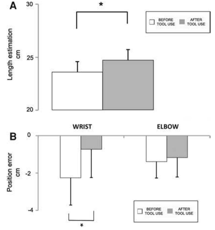 Experiment 2 results, body-landmarks localisation task.