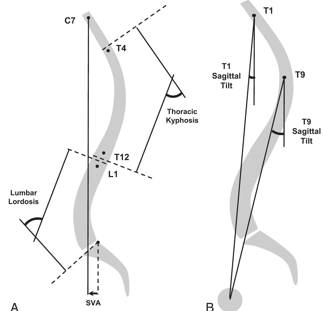 Figure 2 - Standing Balance and Sagittal Plane Spinal