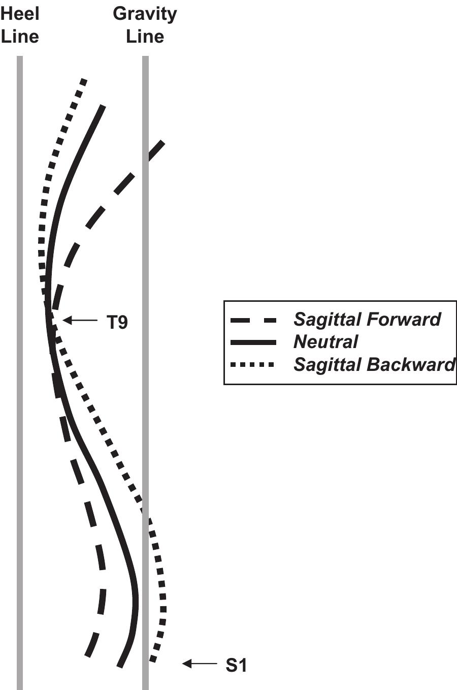 Figure 4 - from Standing Balance and Sagittal Plane Spinal