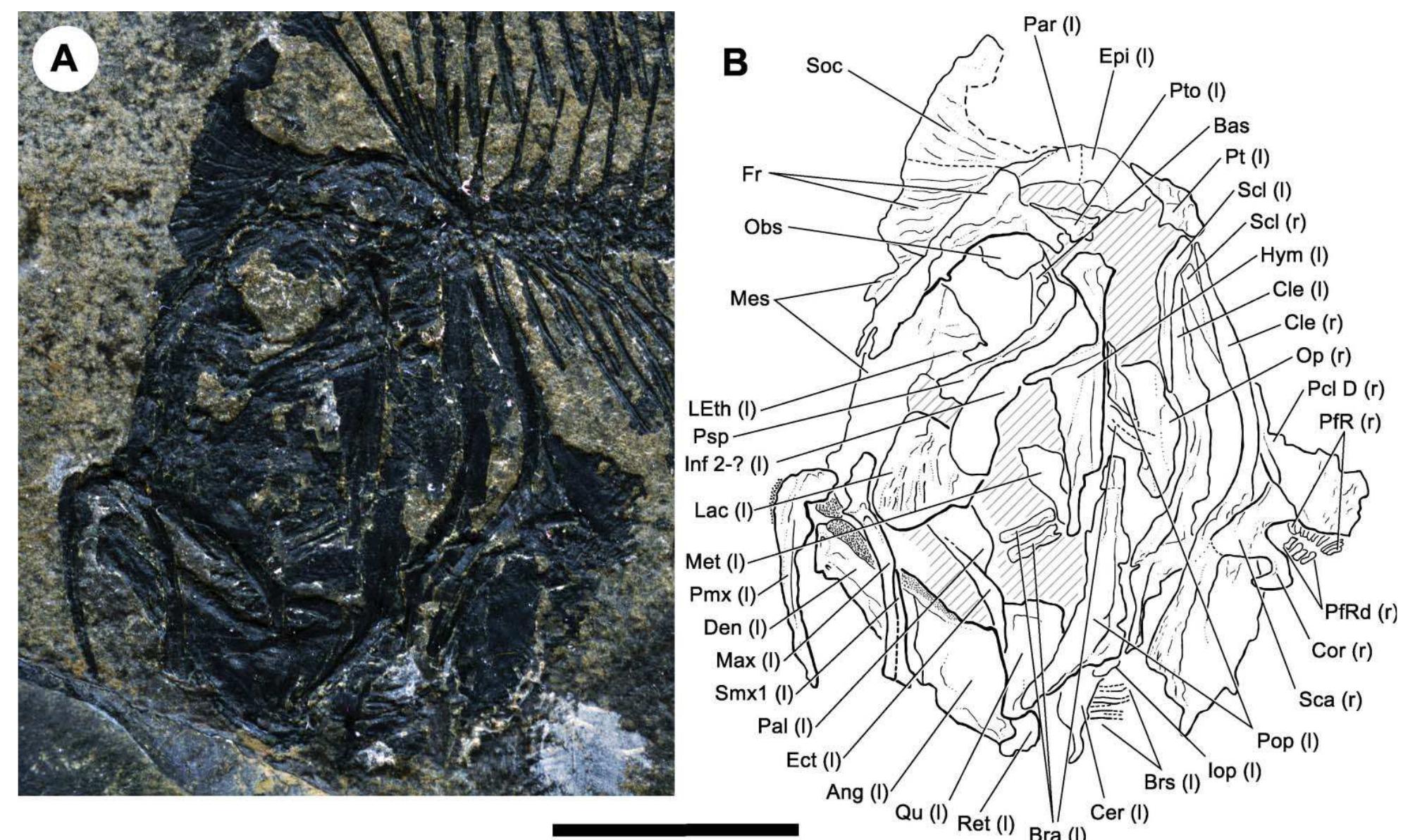 Cranial and pectoral anatomy of {aipichthys pretiosus,