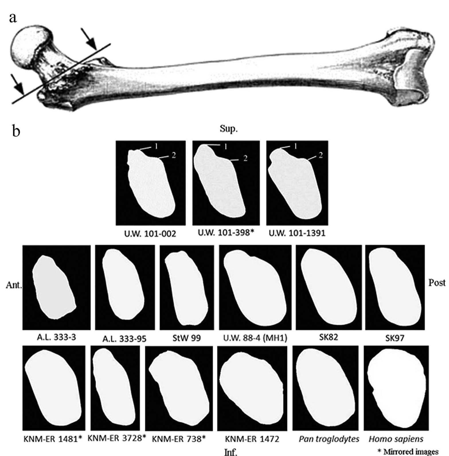 Femoral neck sagittal outlines. (a) black arrows indicate