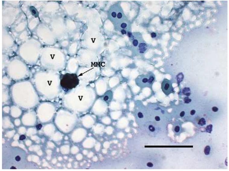 Impression smear of hepatocytes with large, discrete,