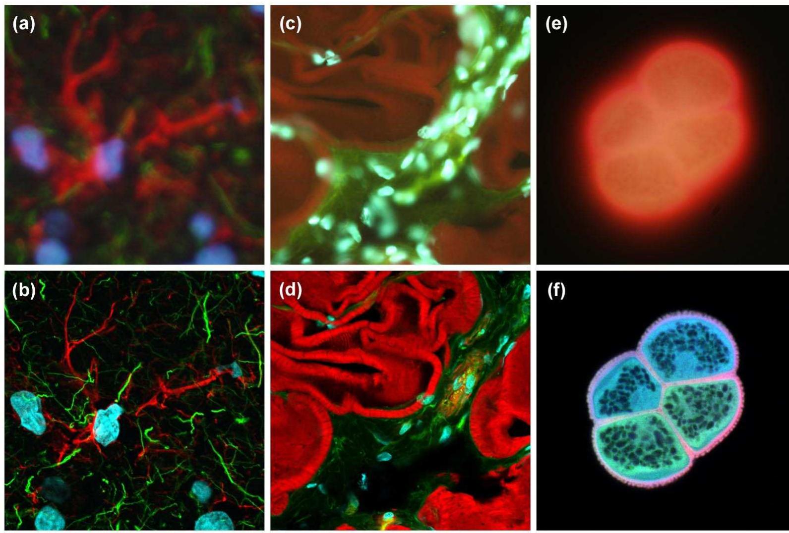 Confocal microscopy offers several advantages over