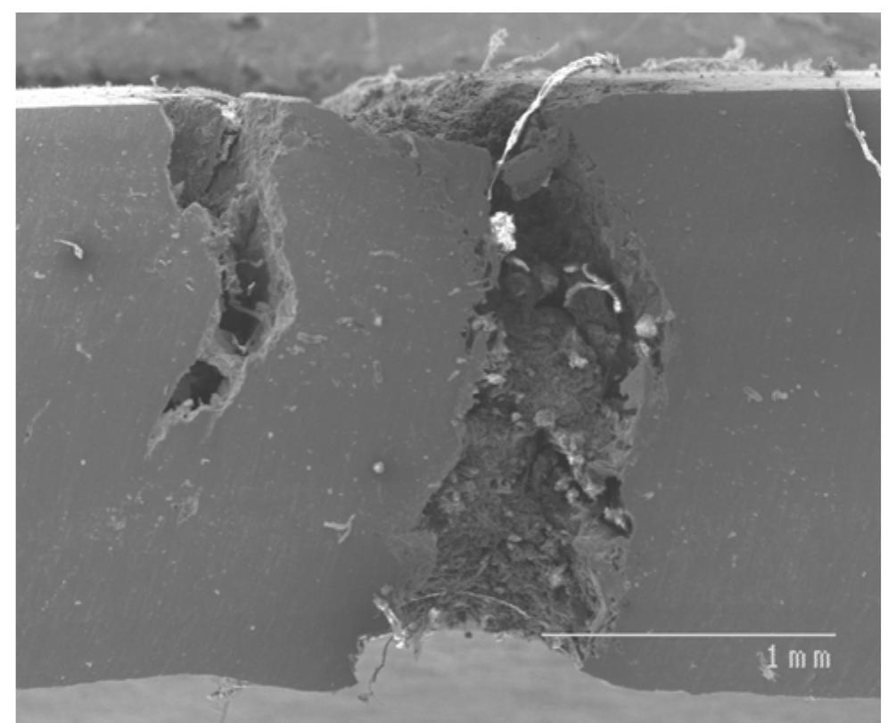 - a longitudinal section of tube b wall showing branching