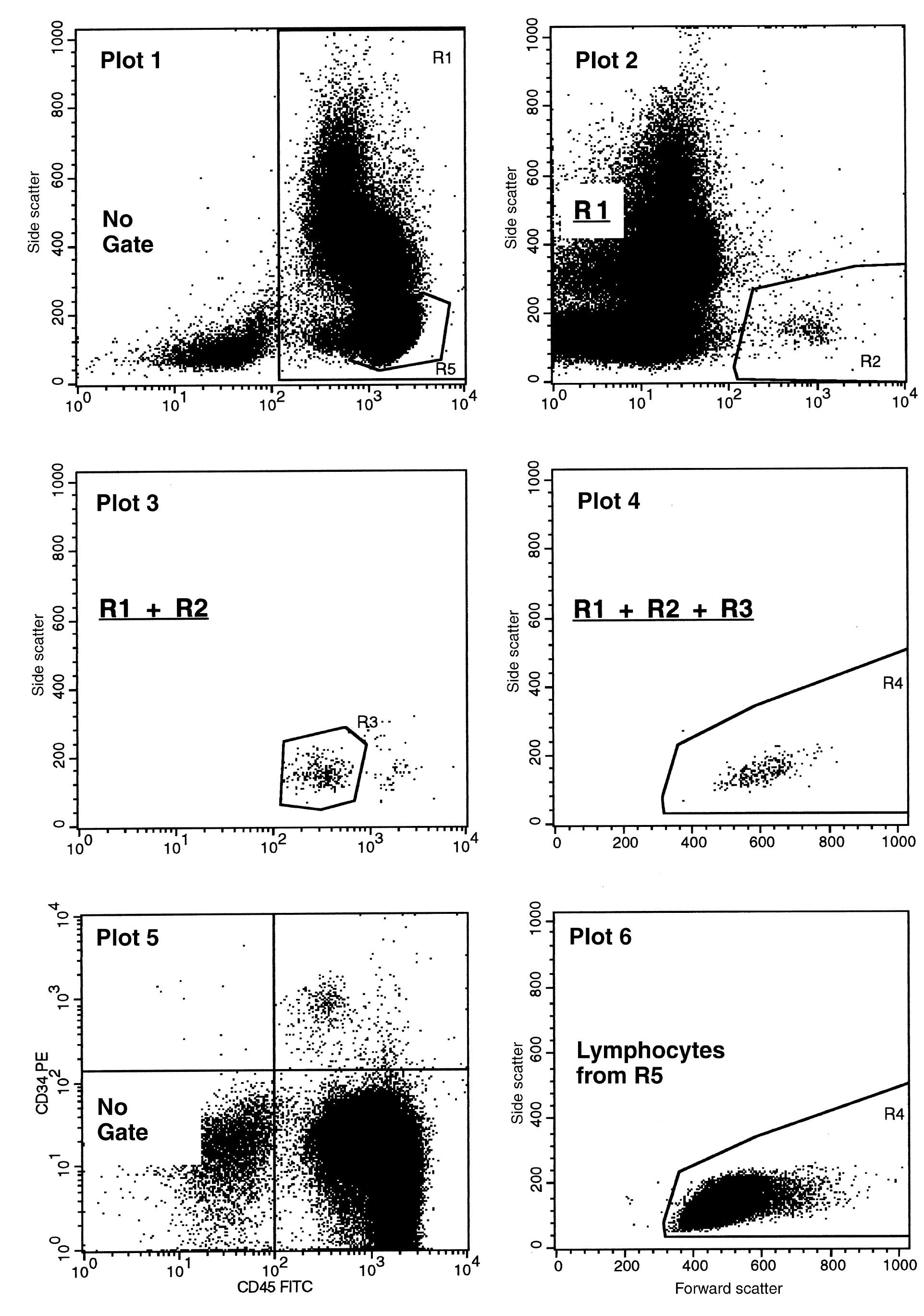 A peripheral blood sample analysed for cd34* stem cells