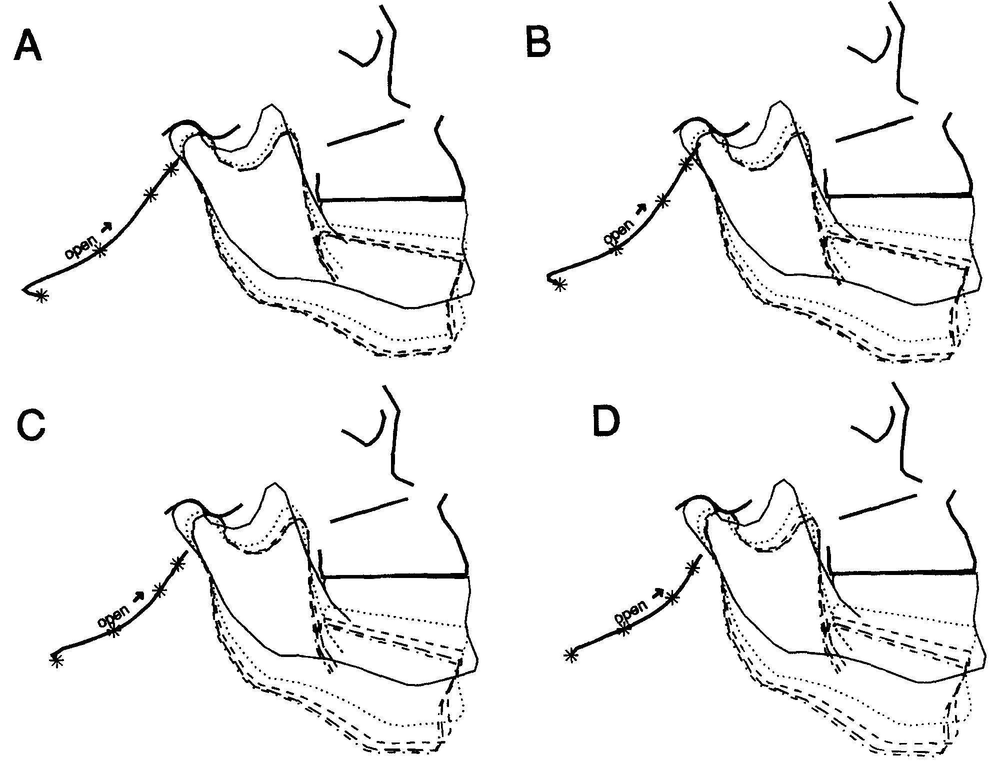 Simulated jaw-opening movements at different levels of