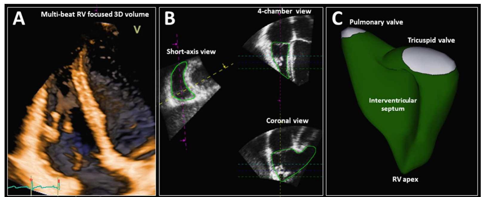 (PDF) GUIDELINES AND STANDARDS Recommendations for Cardiac Chamber ...