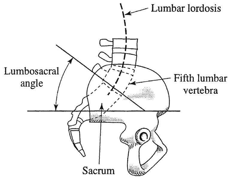 37. the lumbosacral angle is defined as that between the