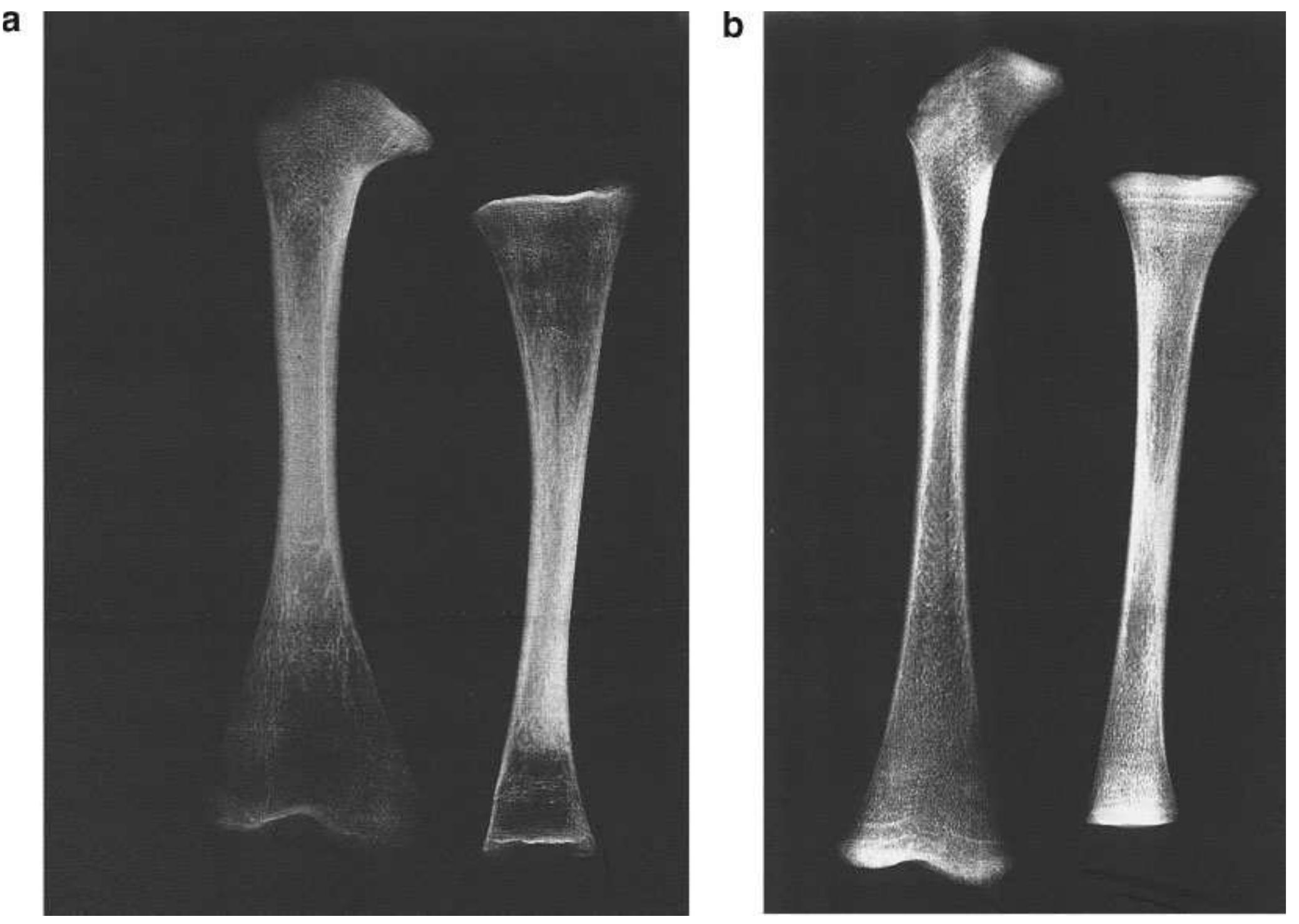 A: anterio-posterior radiograph, femur and tibia, burial