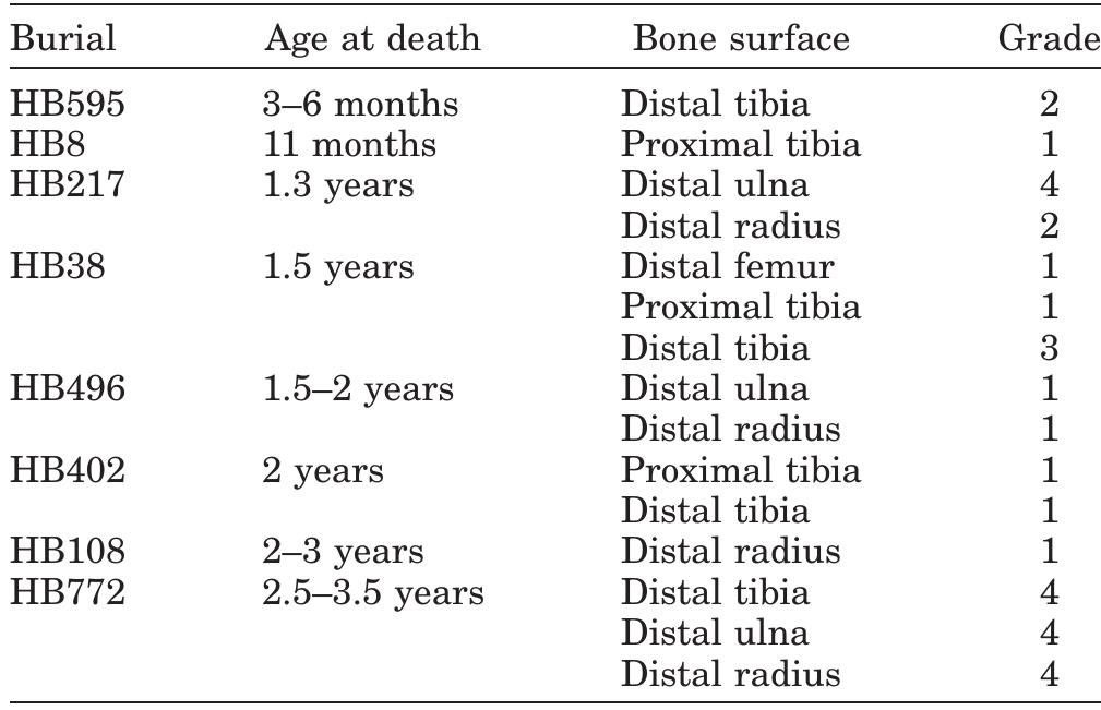 Table 3 - from Skeletal manifestations of rickets in infants