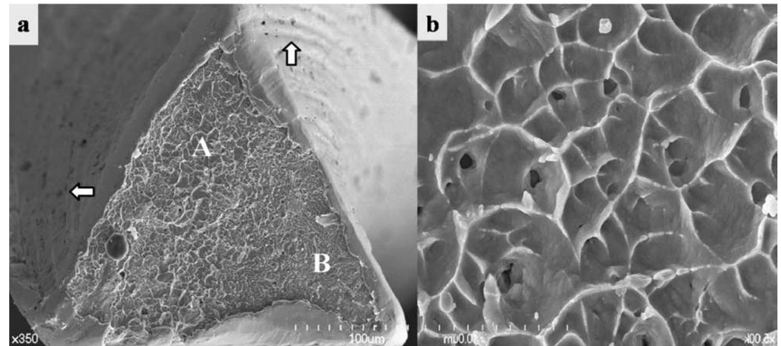 Scanning electron microscope images of the fracture surface