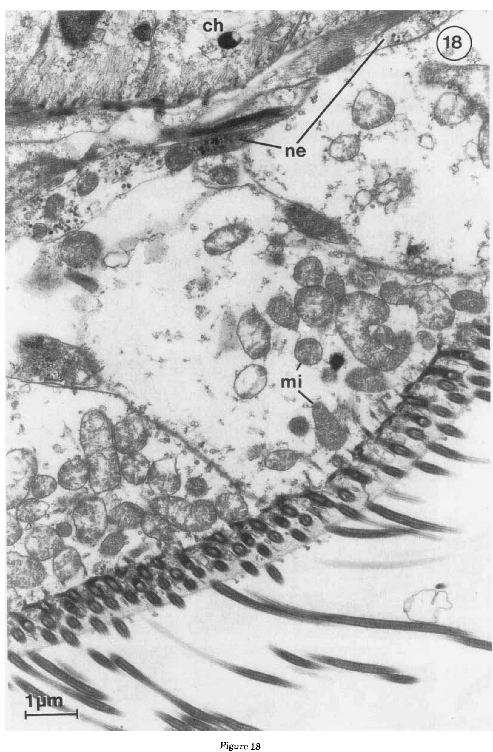 Figure 14 - The chordoid larva ofSymbion pandora