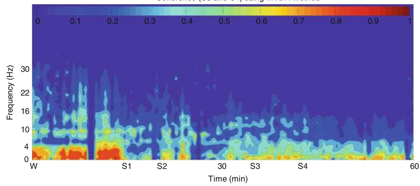 2. the inter-hemispheric mvdr coherence (c3—c4) was computed