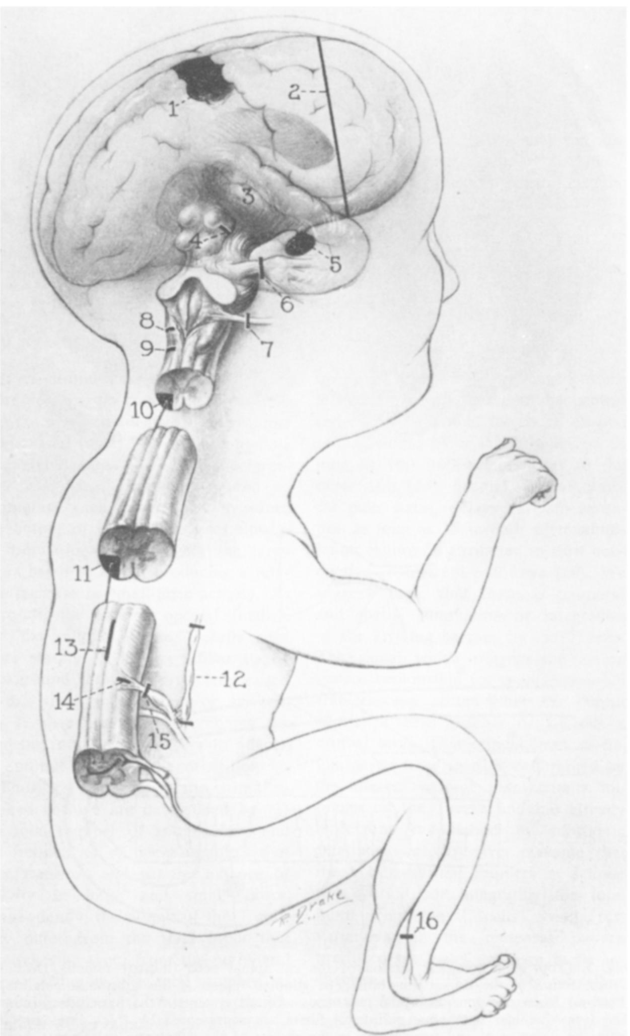 (PDF) Pain Mechanisms: A New Theory
