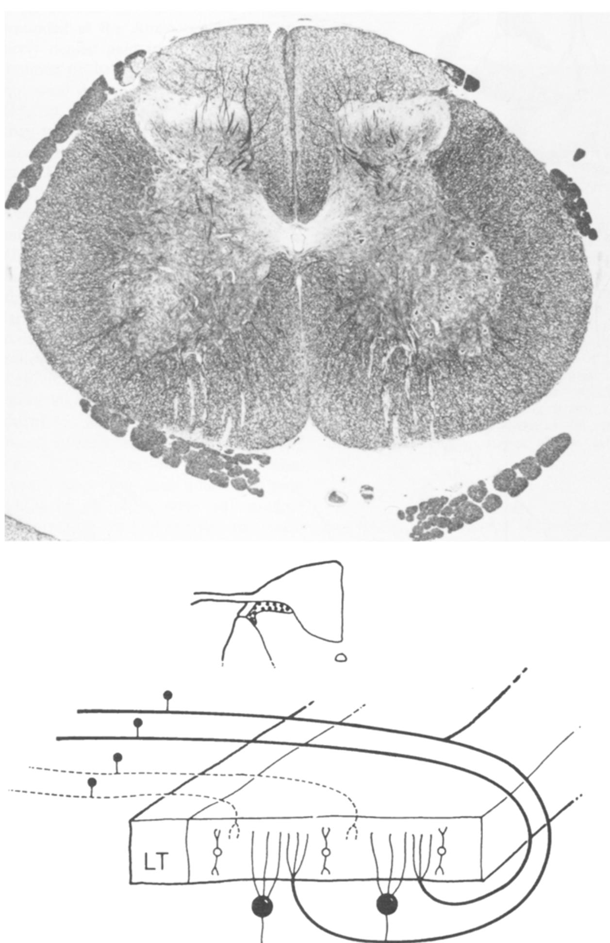 (PDF) Pain Mechanisms: A New Theory