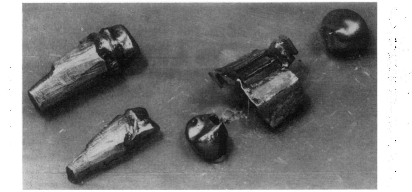 A Precision Attachment Bridge With A Gold Matrix In The