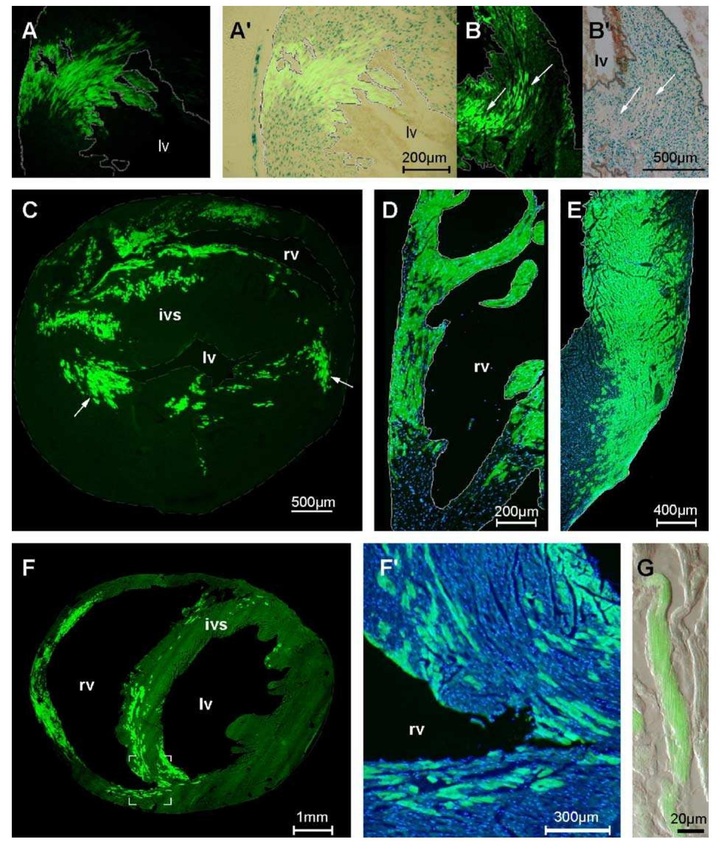 Sections of patches in the ventricular chimeric myocardium.