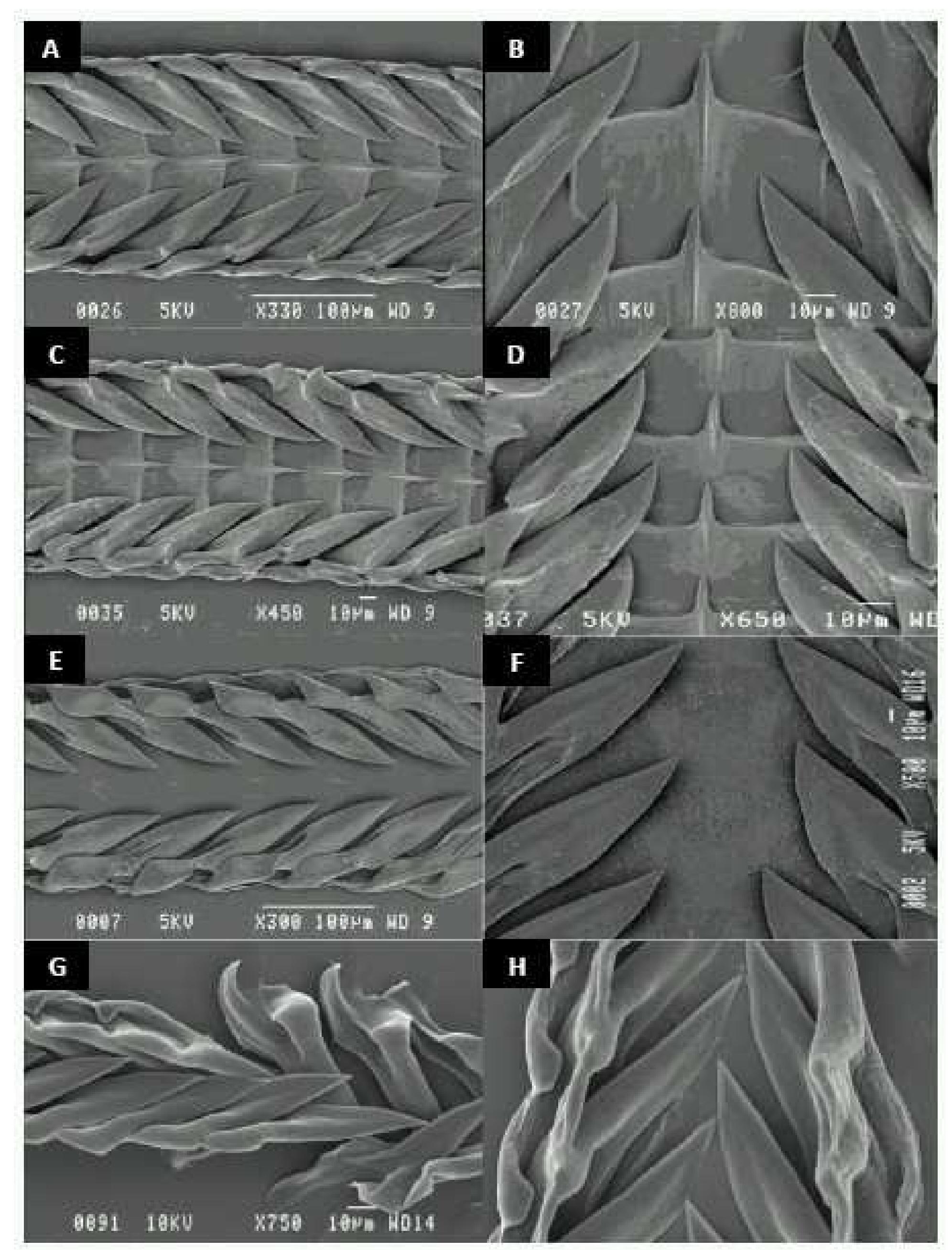 Radular morphology. scanning electron microscopy images of