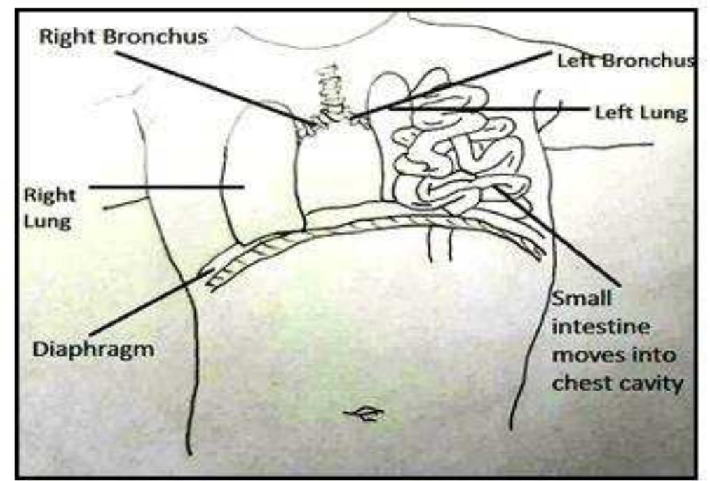 Schematic diagram showing organs from the abdominal cavity
