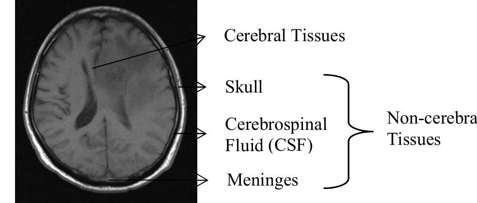 Anatomical of cerebral and non-cerebral tissues two