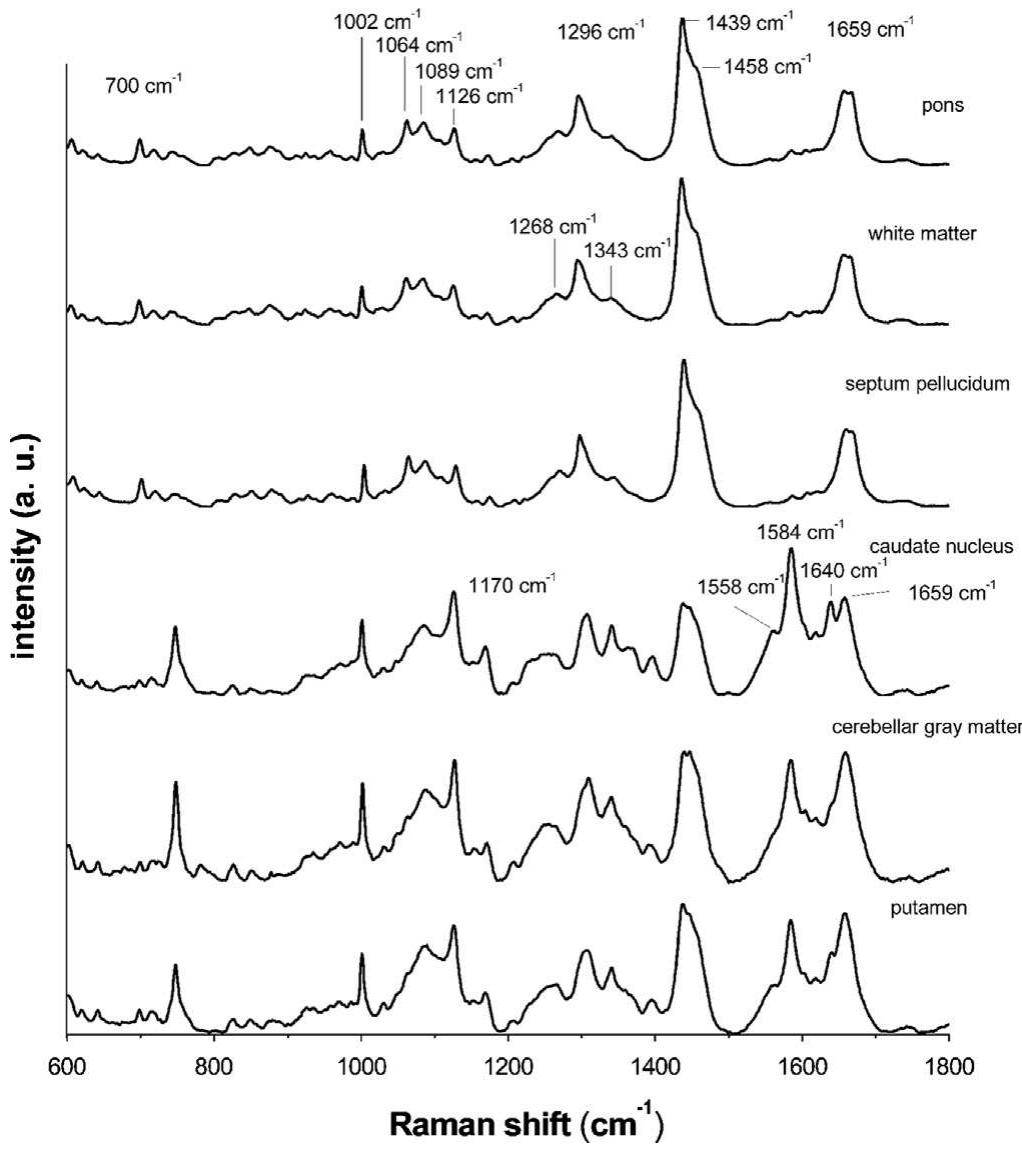 Average raman spectra of analyzed brain structures.