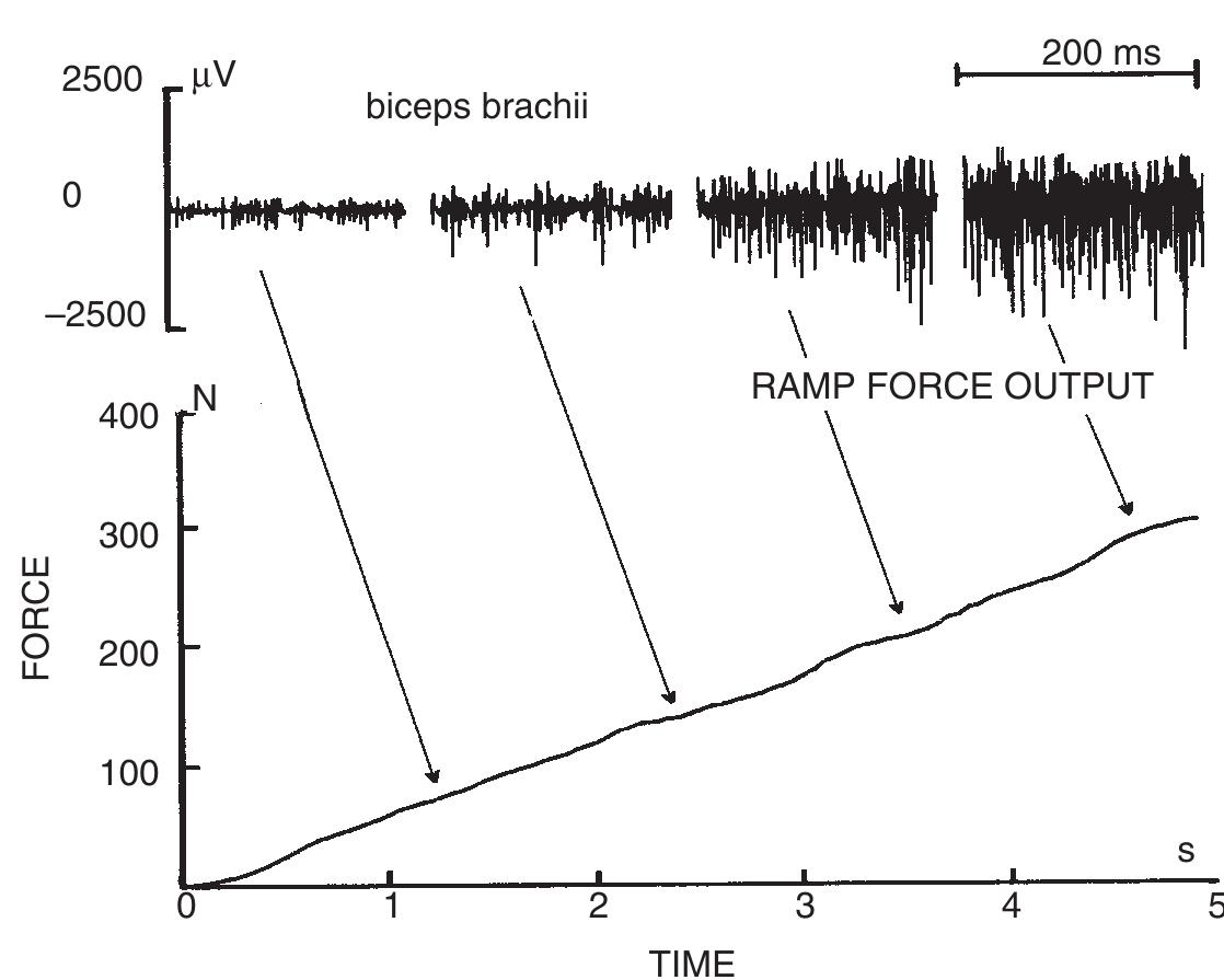 6. intramuscular spike recordings obtained from the biceps