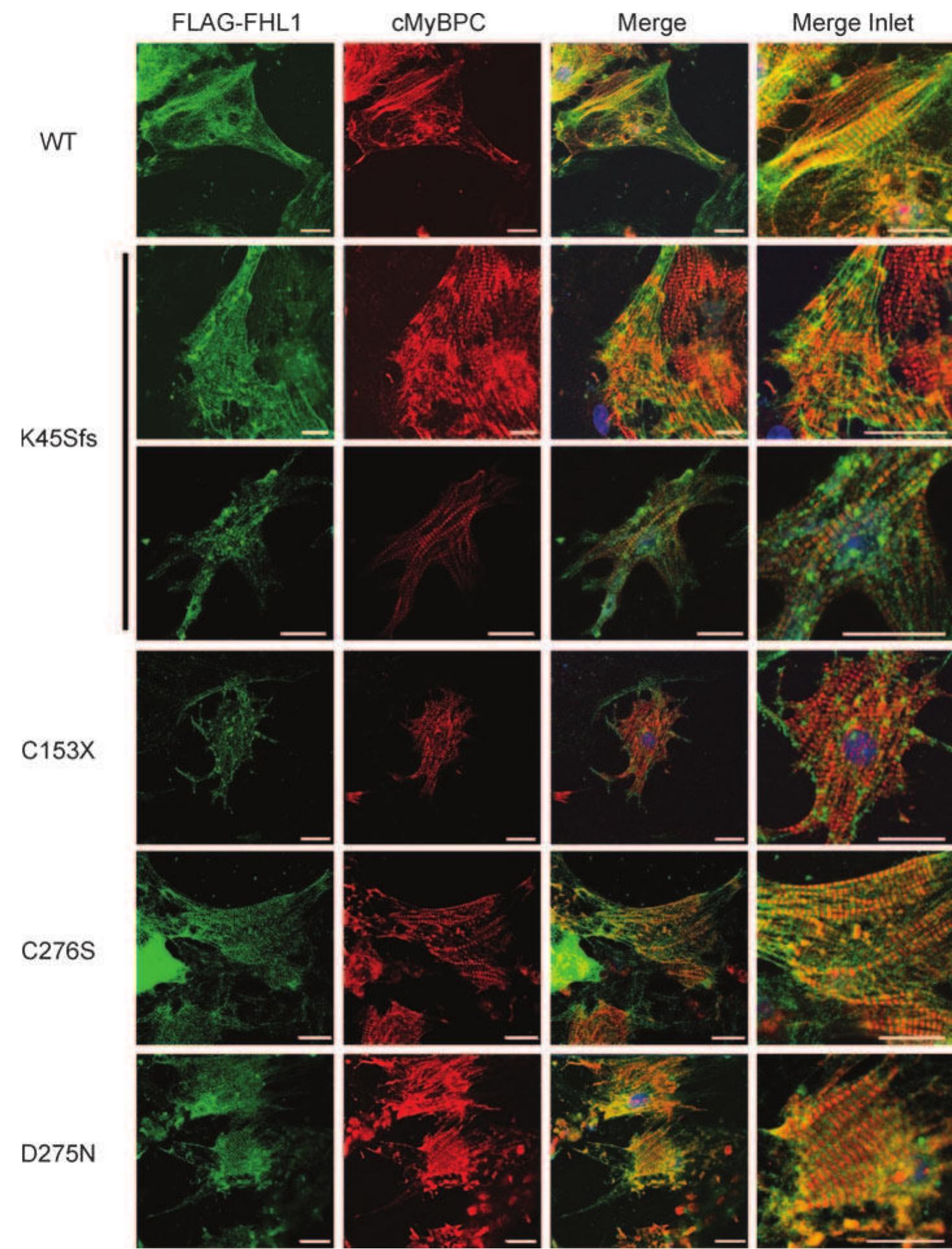 Immunofluorescence images of cardiac myocytes transduced