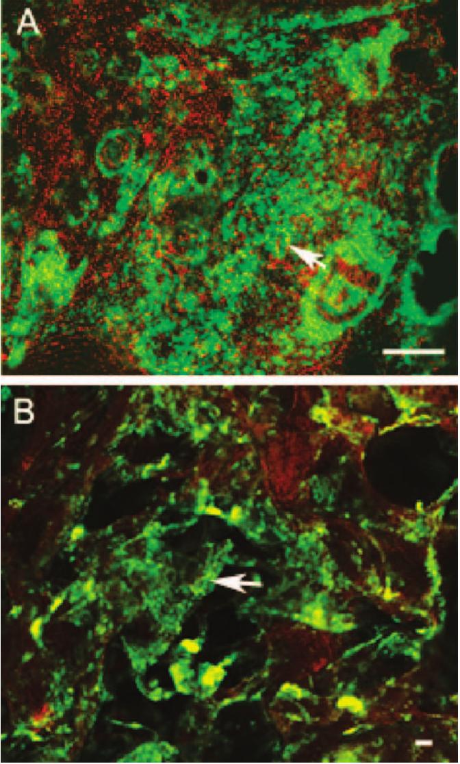 Clsm images of immunostained s.20.20.0. the arrow in image a