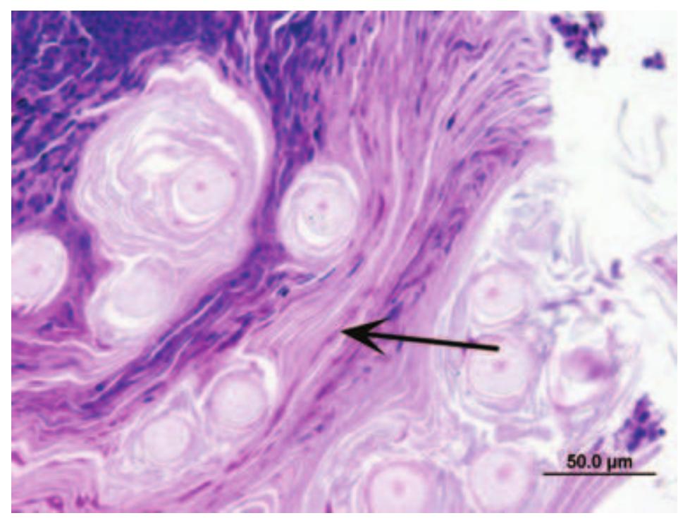 Photomicrograph of skin-biopsy specimen from an alpaca with