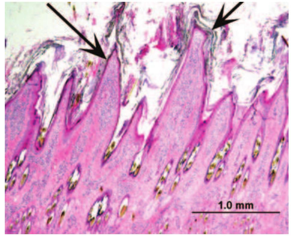 Photomicrograph of skin-biopsy specimen from an alpaca with