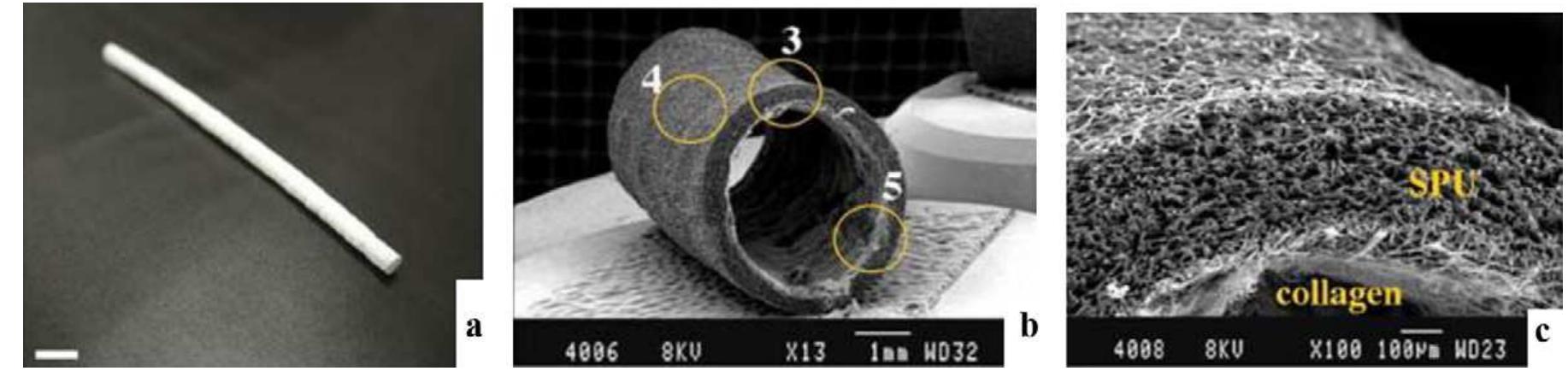 Fabricated bilayered tubular construct of spu/collagen. (a)