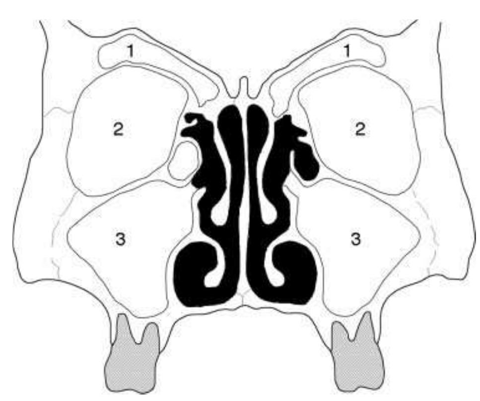 Anterior view of 1: frontal sinus; 2: orbits; 3: maxil- lary