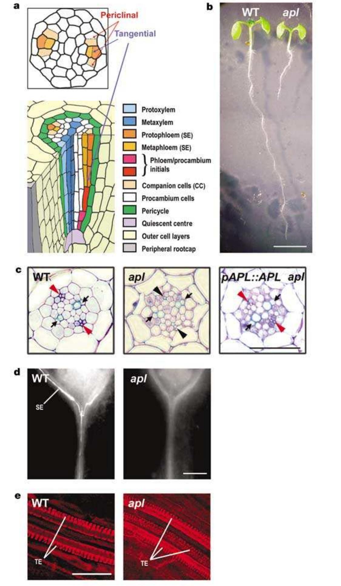 Ap/ has an altered vascular pattern. a, schematic of