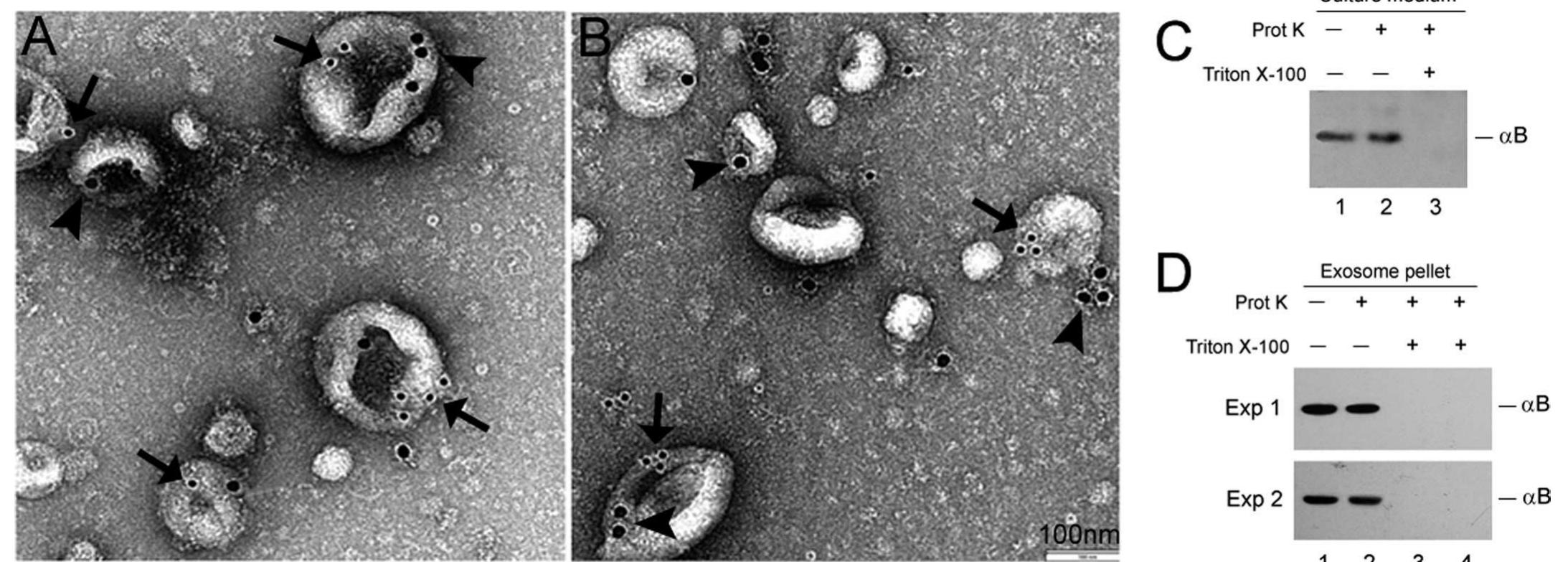 Tem-immunogold labeling of the native exosomes and