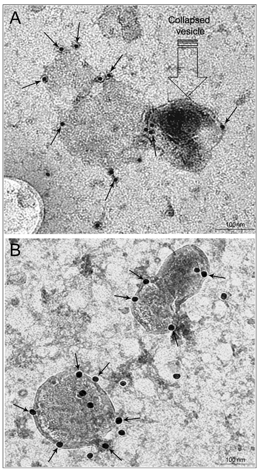 Tem-immunogold labeling of exosomes exposed to triton x-100.