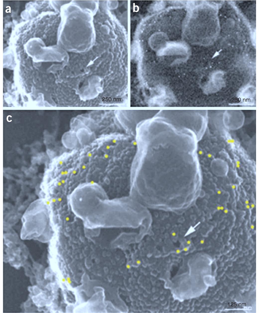 | immuno-scanning electron microscopy (immuno-sem)
