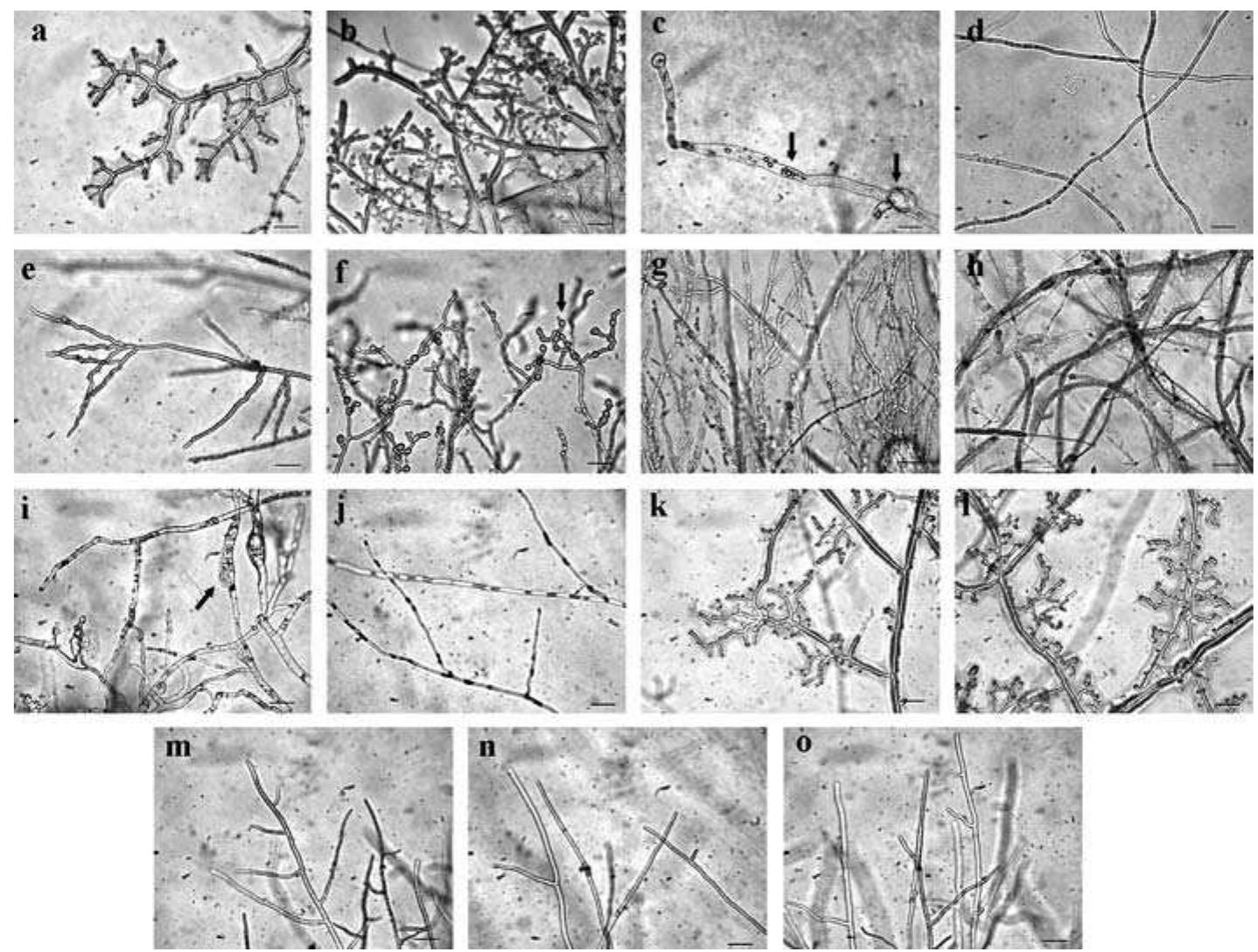 Photomicrographs showing hyphal morphological alterations in