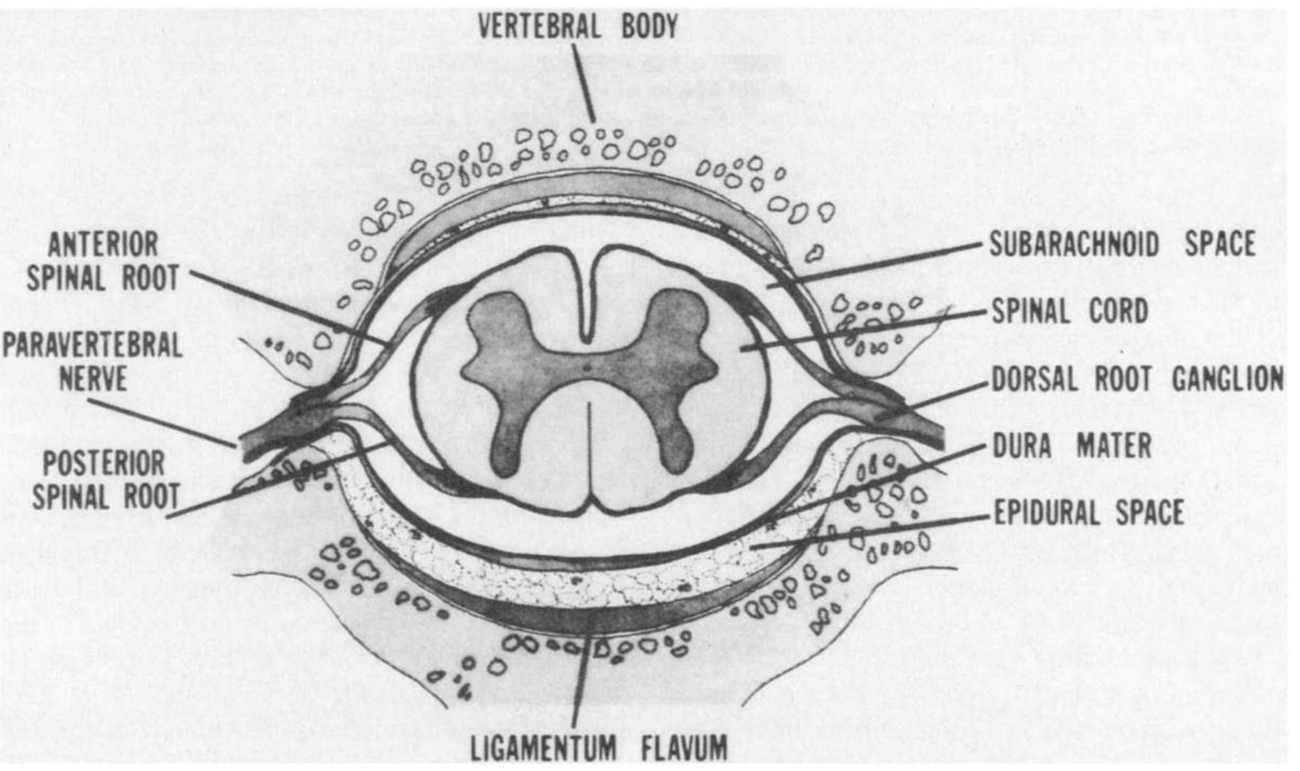 Cross section of the spinal cord identifying the epidural