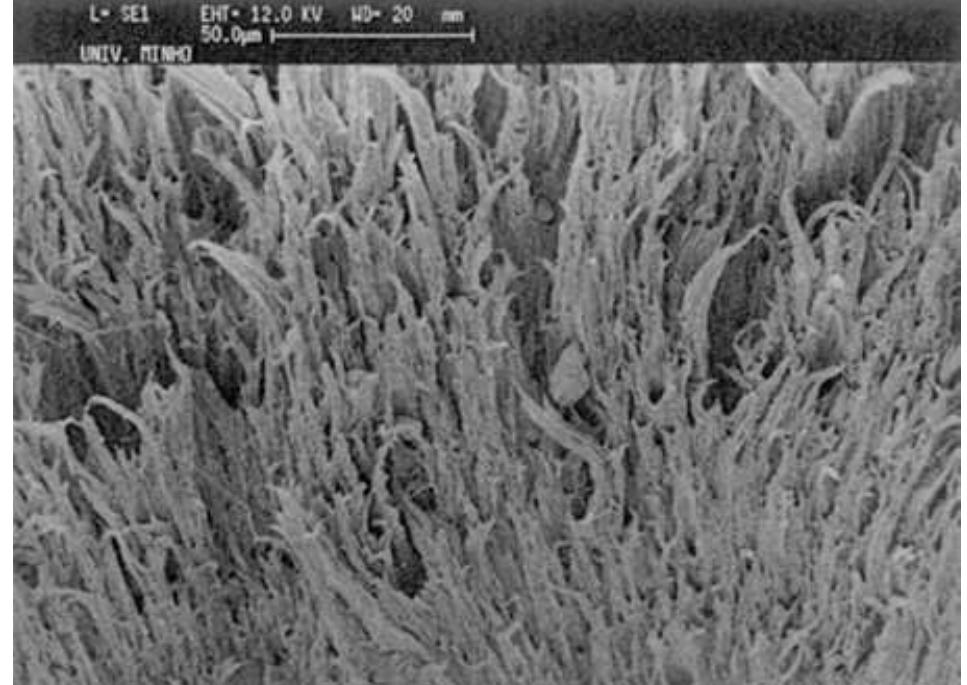 Scanning electron microscope (sem) photograph of the typical