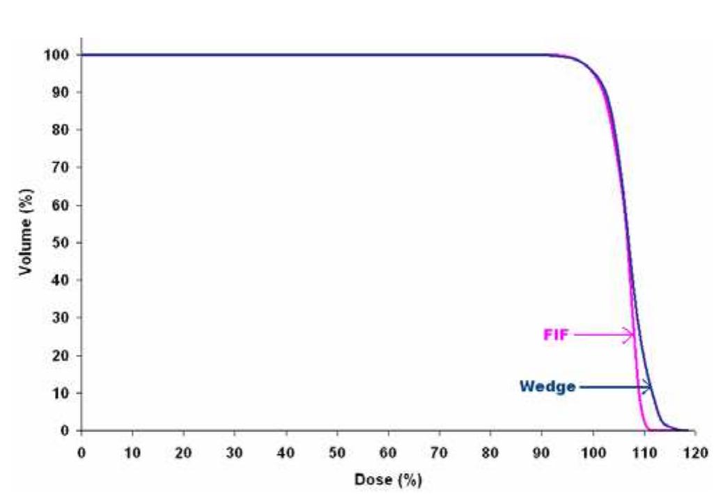 Dvh comparison of wedge versus fif technique in a tangential