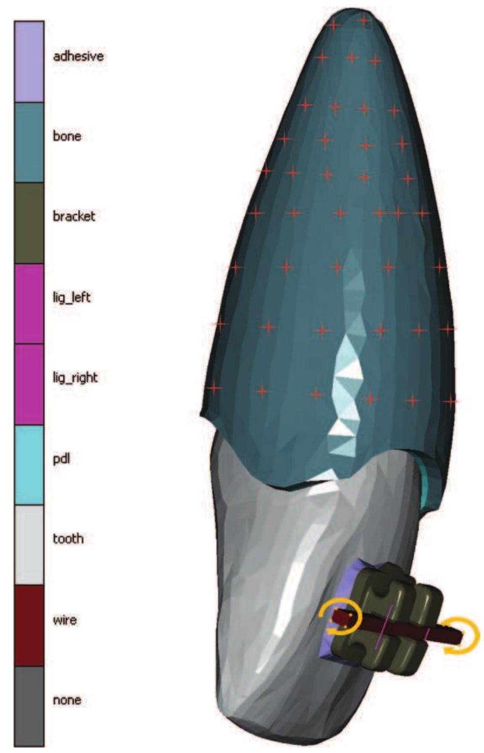 (PDF) Torque differences according to tooth morphology and bracket ...
