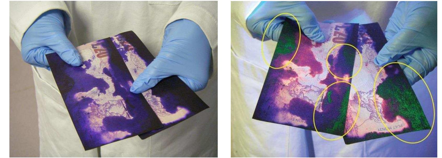 A) staining under normal light conditions b) staining under