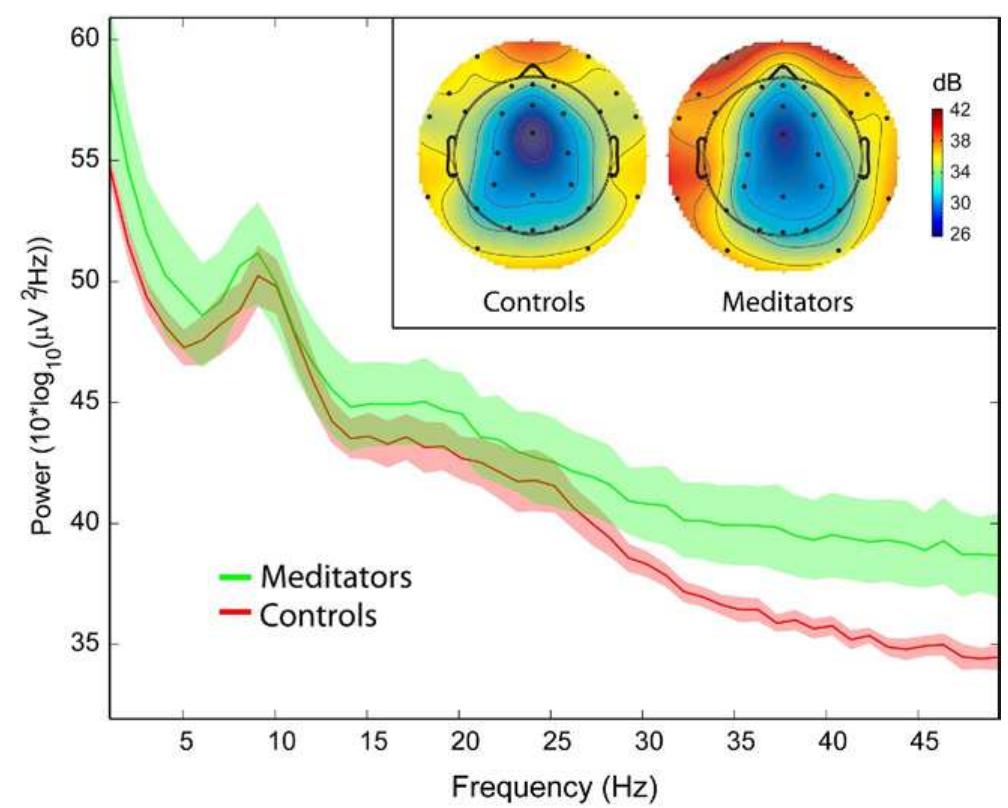 Inset Scalp Maps Showing Spectral Power Scale In Db For