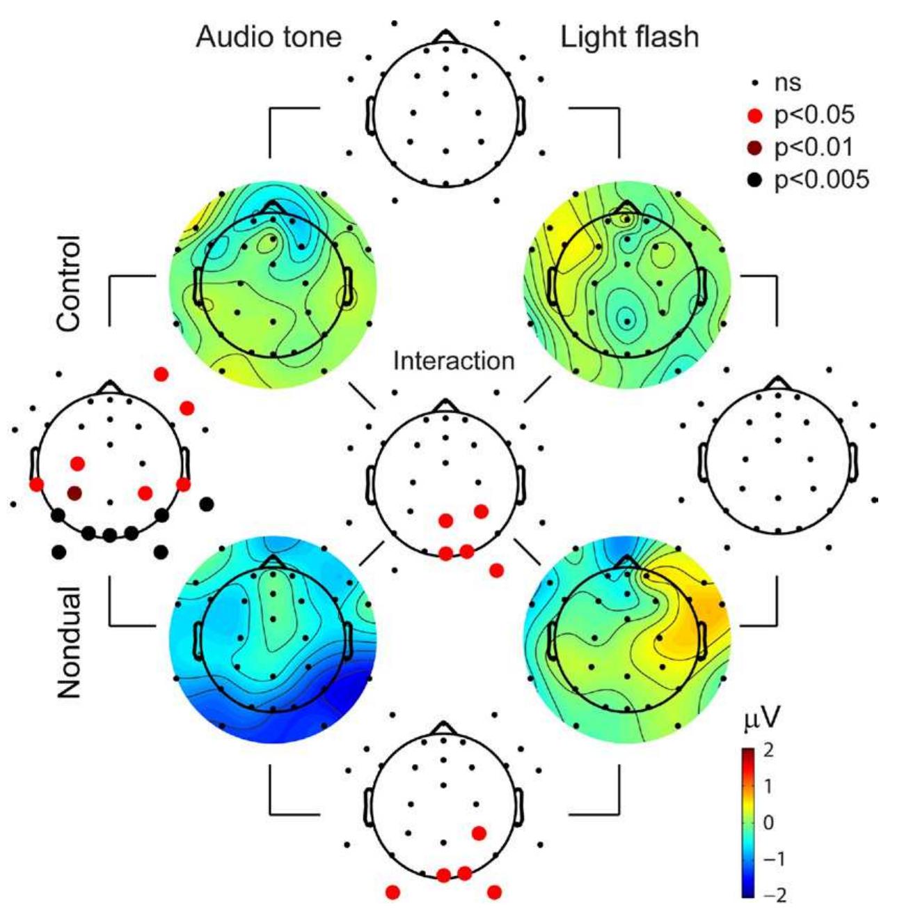 Average cortical electrical potentials (color scale in