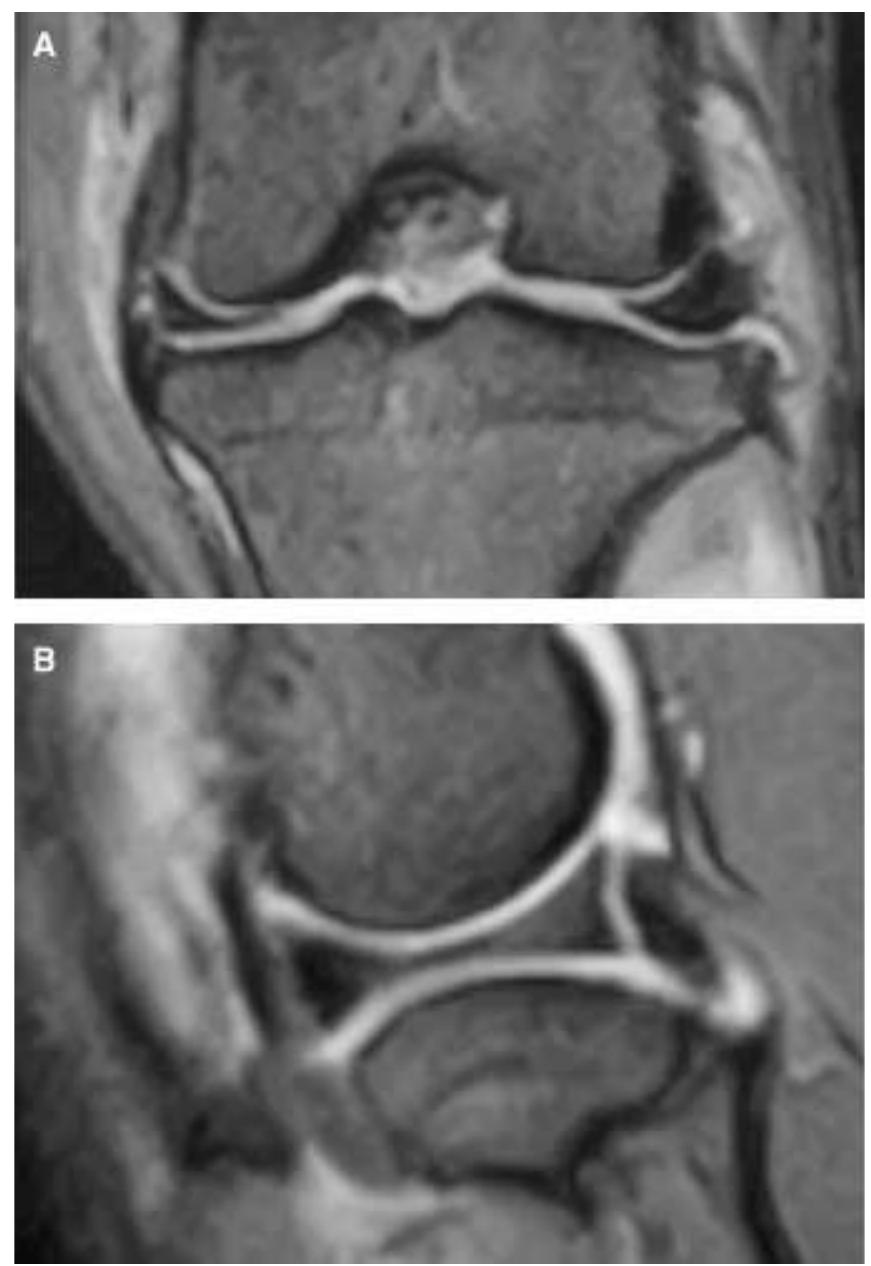 Fic. 1. (a) dorsal t2*-weighted image of the stifle joint of