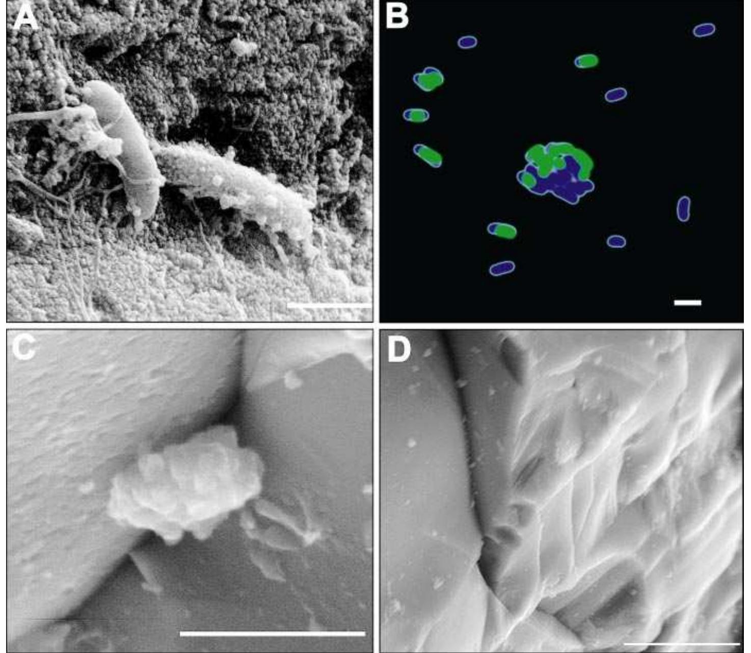 A: scanning electron microscope (sem) photomicrograph of