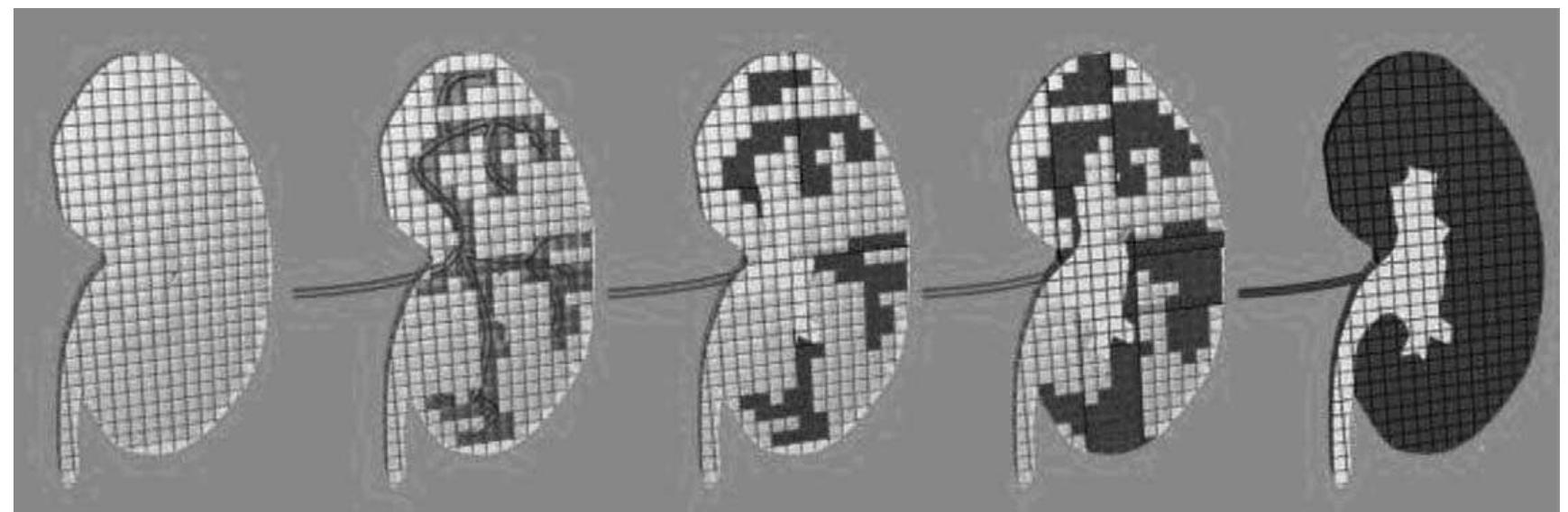 Schematic process of heterogeneous tissue block assembly for