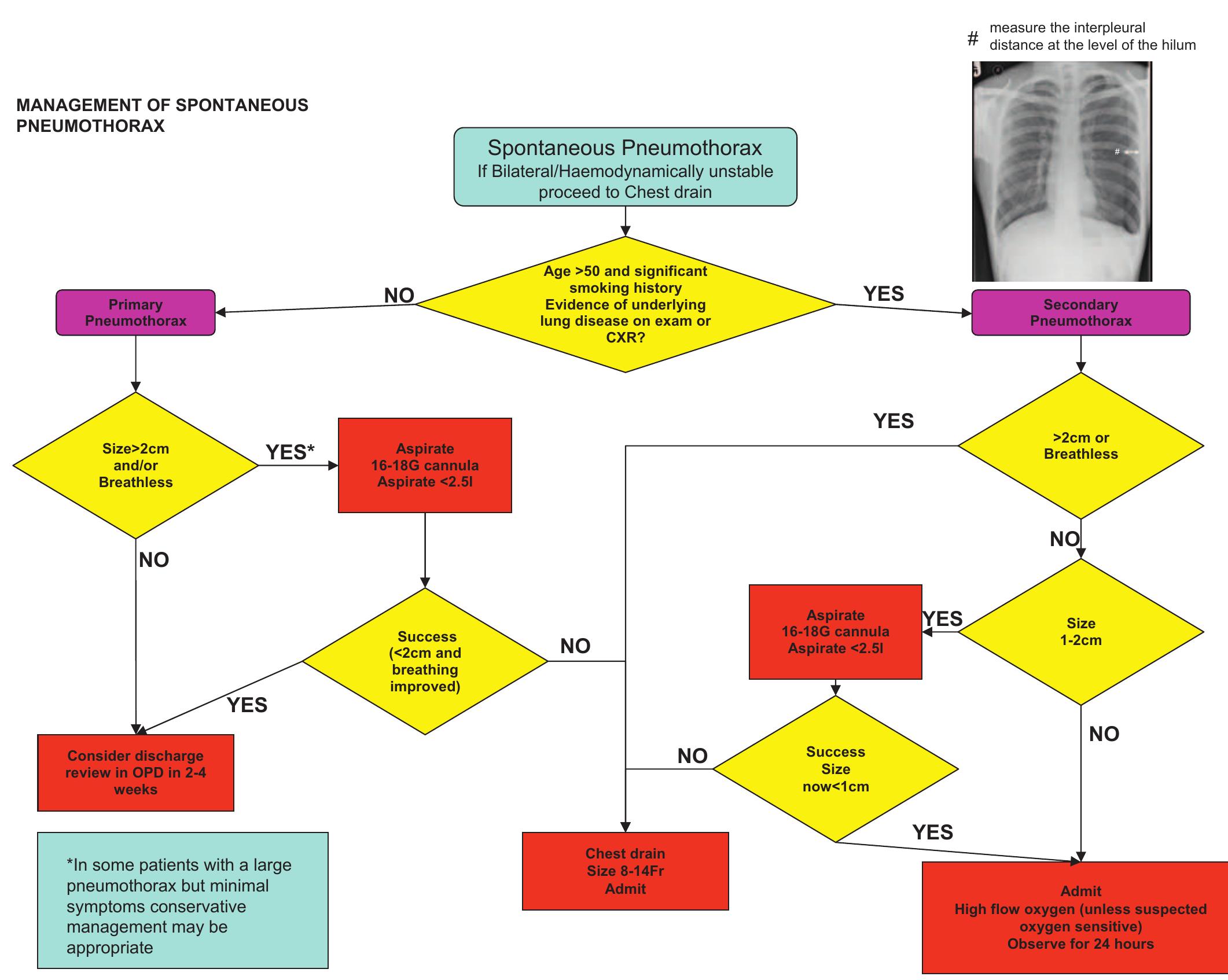 Flowchart of management of spontaneous pneumothorax.