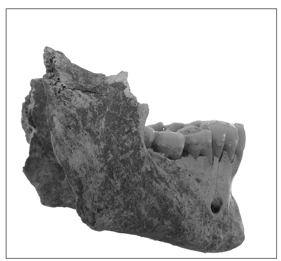 Lateral view of the mandible. fig. 11. frontal view of the