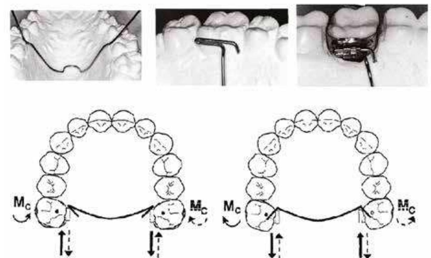 Method to use the tpa for molar rotation and derotation.